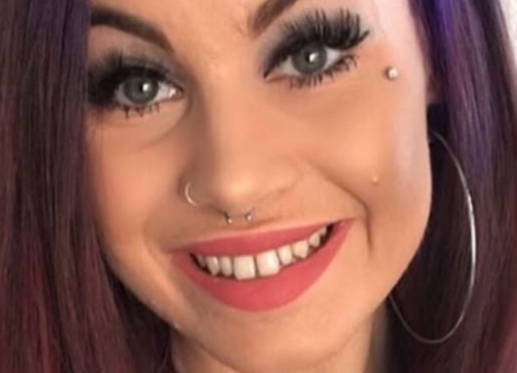 Bad Composite Bonding - What to Look Out For | The Perfect Smile Studios